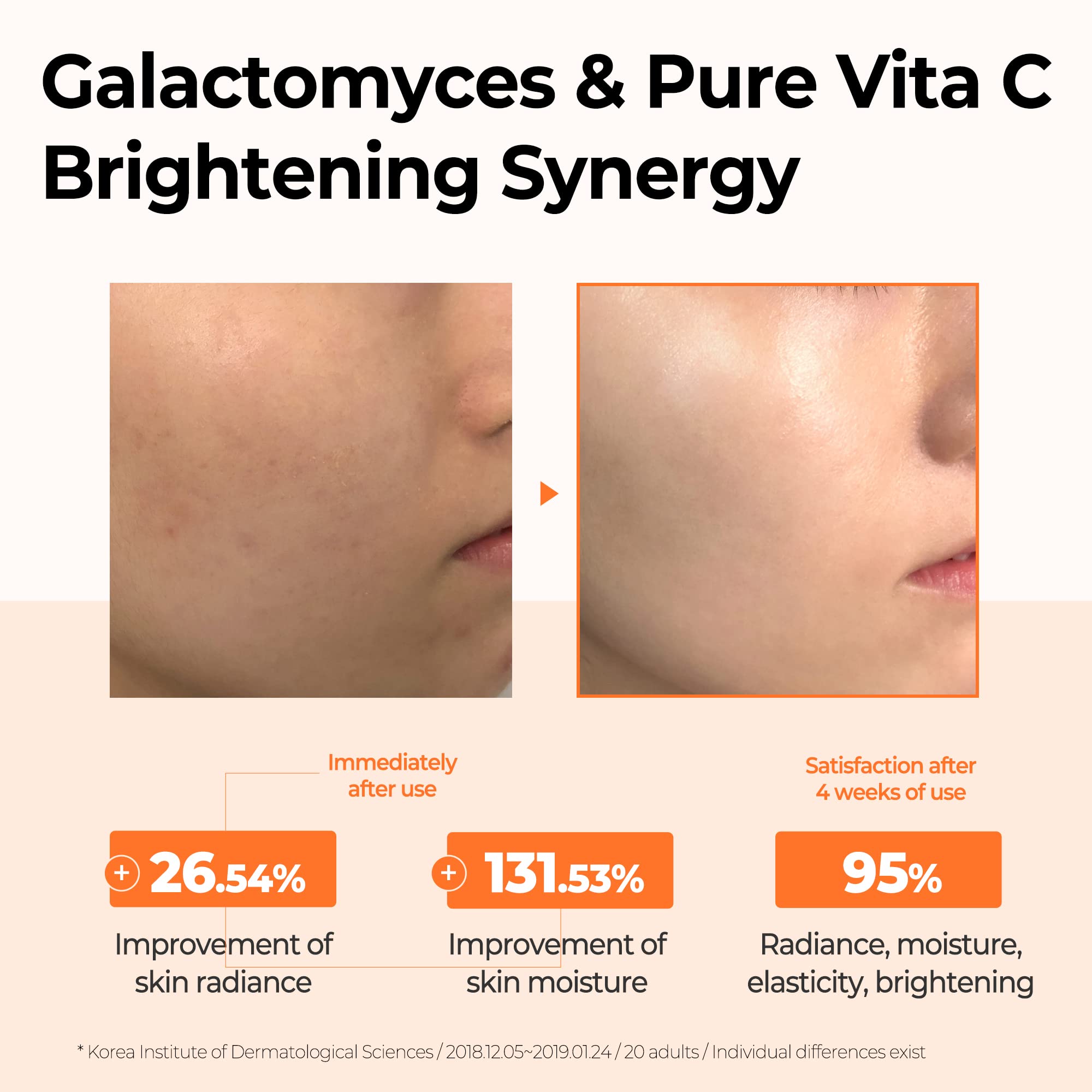 Galactomyces Pure Vitamin C Glow Toner - Kaloka Beauty